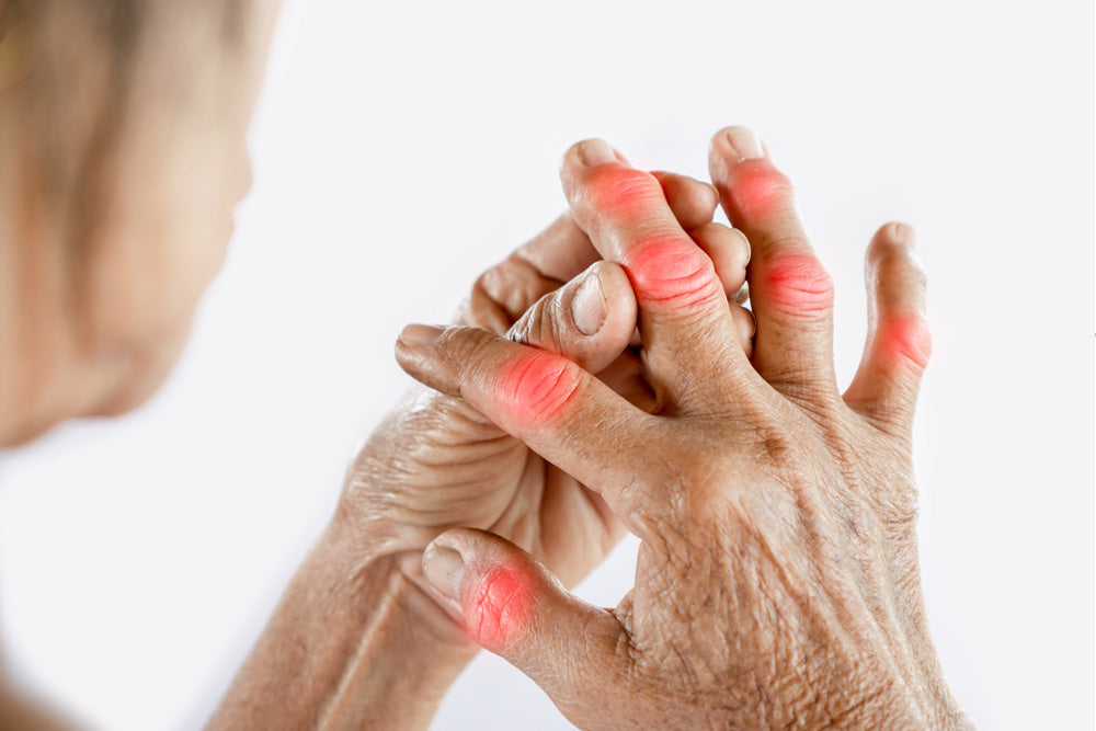 A Guide to Living with Arthritis in Ireland | Meaghers Pharmacy