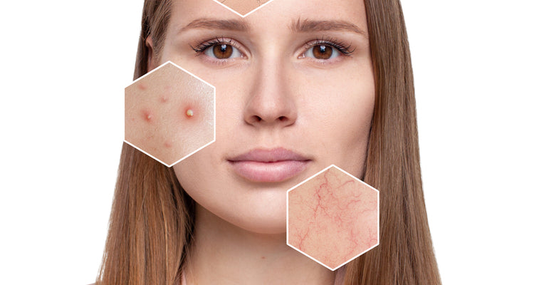 Creating a Core Routine for Combination Skin — Meaghers Pharmacy