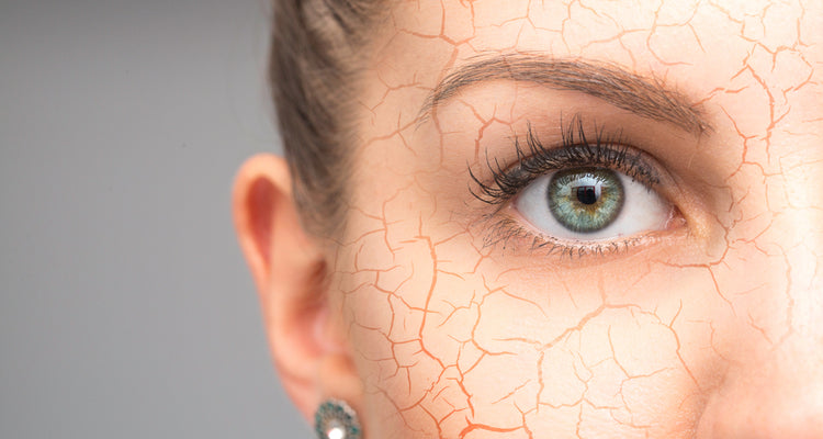 Signs of dehydrated skin and how to treat it – Meaghers Pharmacy